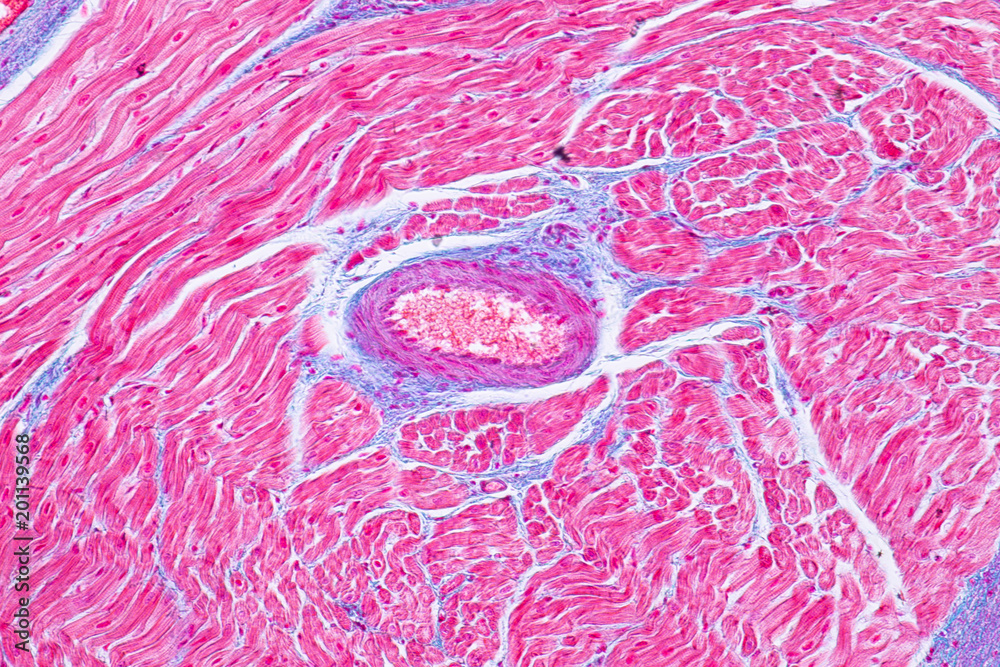 Histology of human cardiac muscle under microscope view for education ...