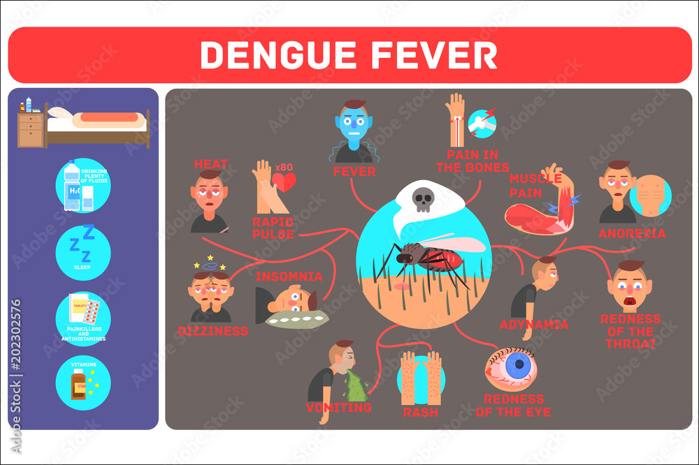 Dengue fever concept. Mosquito-borne tropical disease. Infographic ...