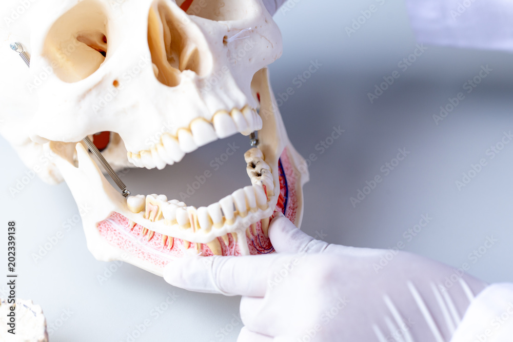 Foto de Stock Study cast of Diagnostic cast and dental gypsum models in ...