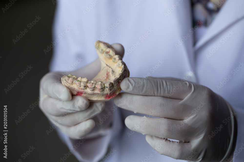 Стоковое фото «Study cast of Diagnostic cast and dental gypsum models ...