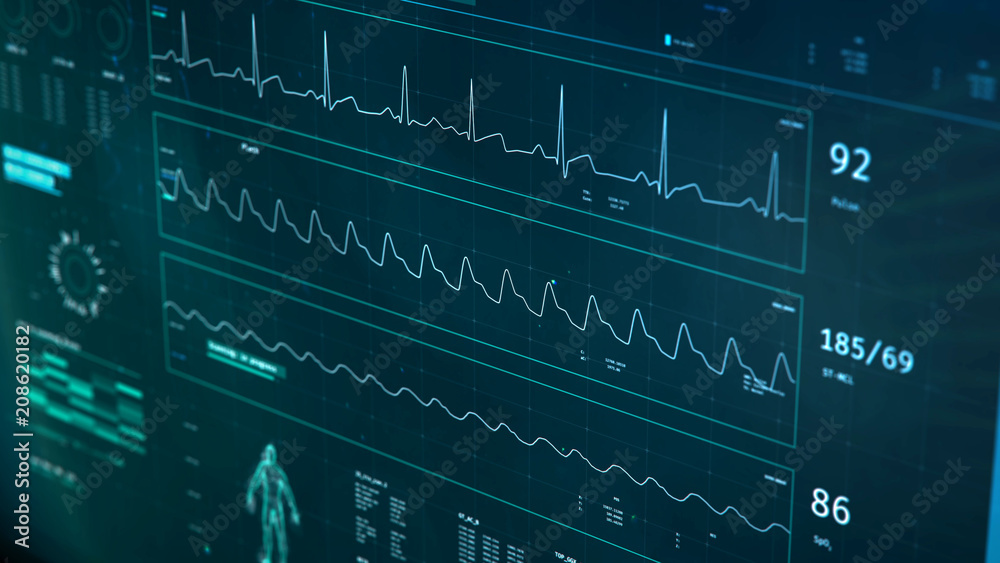 Modern ICU monitor in expensive clinic, patients vital signs monitored ...
