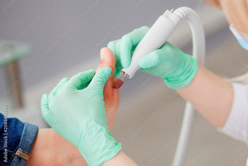 podiatrist treats foot using the milling machine. Stock Photo | Adobe Stock