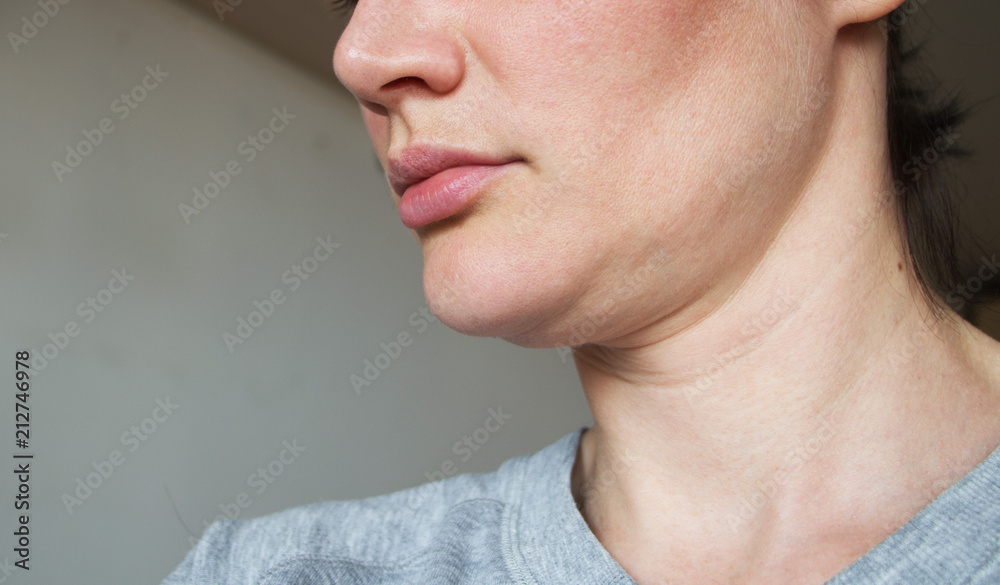 sagging chin. face line correction Stock Photo | Adobe Stock