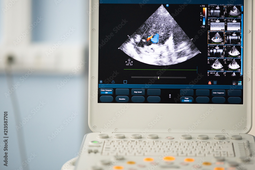 Screen of an ultrasound device with a heart scan. The Doppler method ...