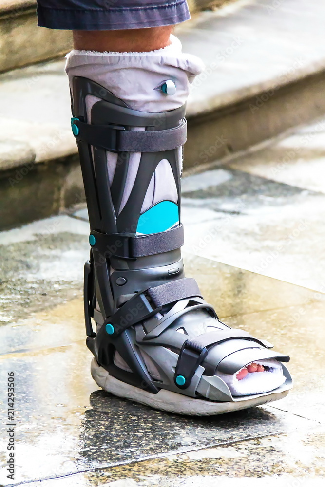Stock-Foto „Ankle Brace - Aircast Flat Foot PTTD Brace, Aircast,Boot ...