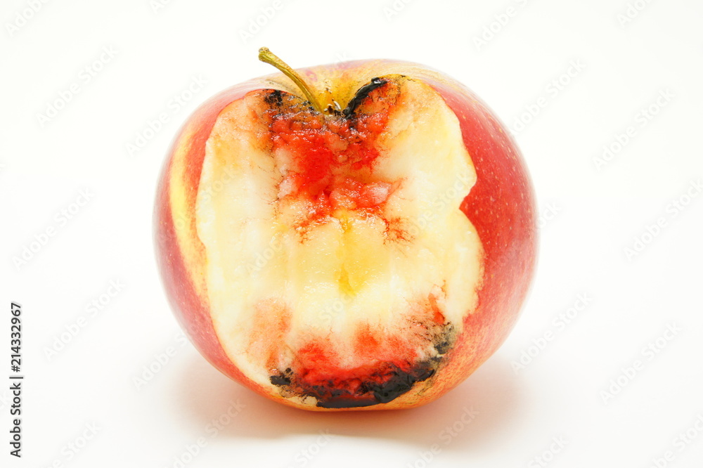 Gingivitis. Periodontitis. Apple with simulated lesions of the gums. の ...