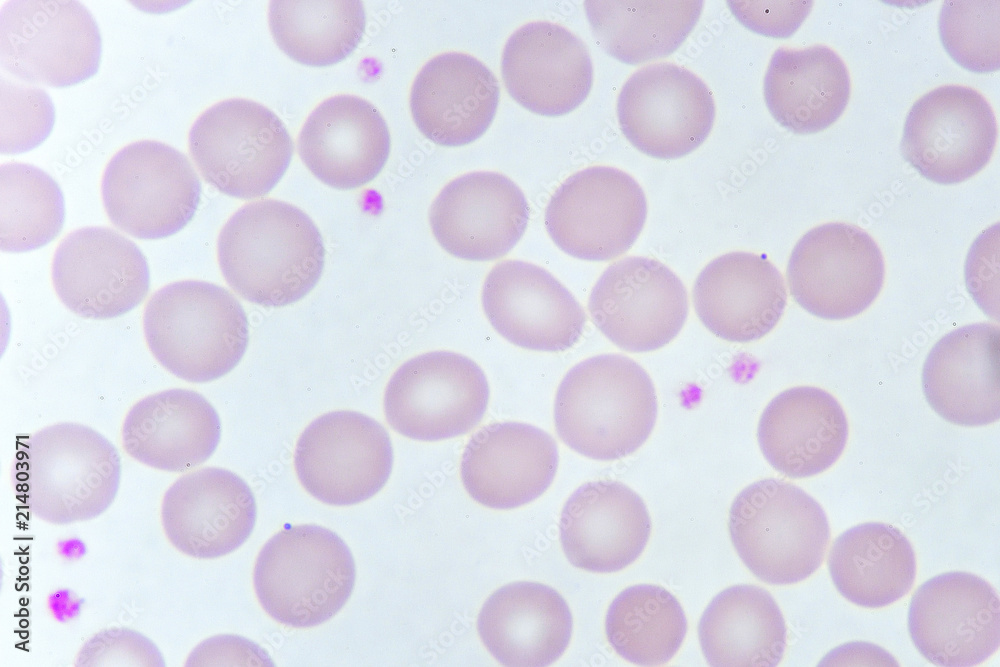 Red blood cells and platelet in blood smear, analyze by microscope ...