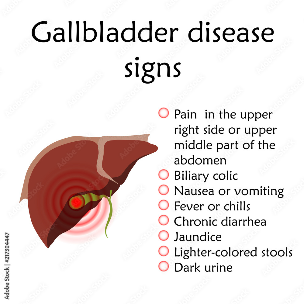 Inflamed Gallbladder Symptoms