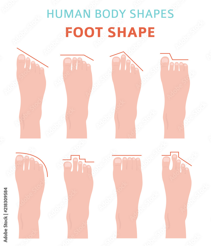 Human body shapes.Feet types icon set Stock Vector | Adobe Stock