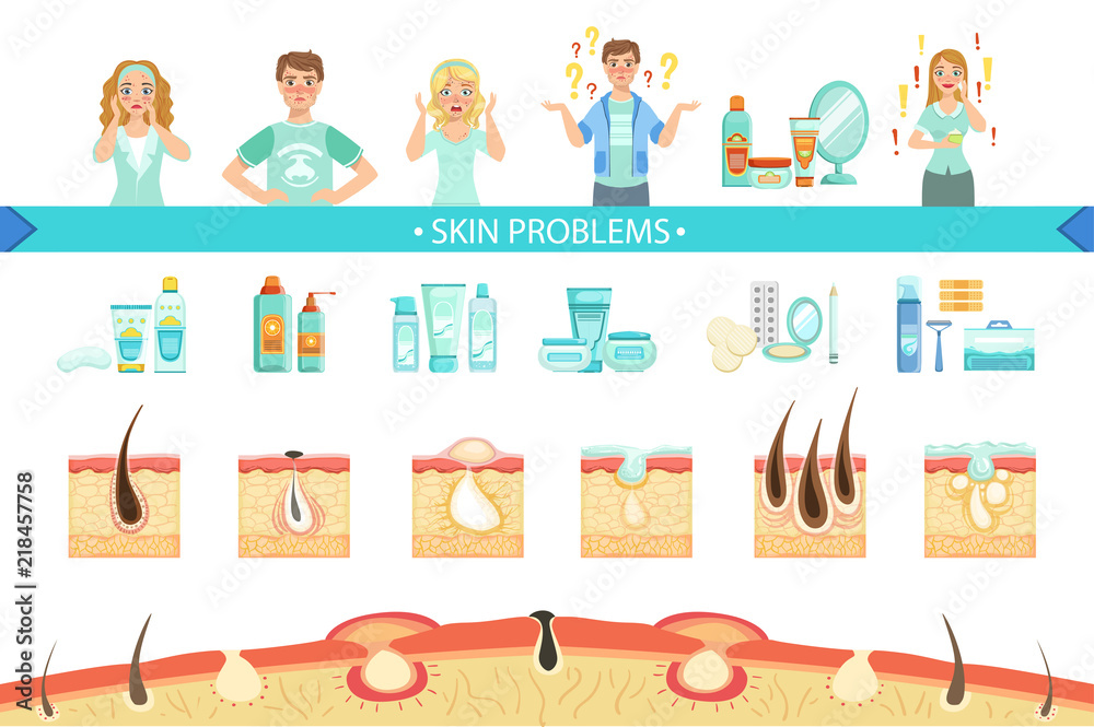 Skin Problems Infographic Medical Poster. Cartoon Style Healthcare Acne ...