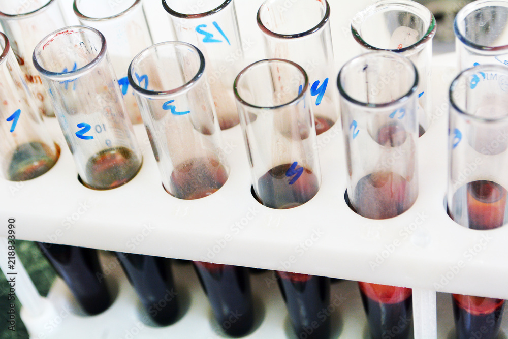 rack of blood tubes with barcode labels for proper identification and ...