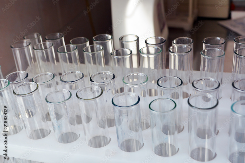 rack of blood tubes with barcode labels for proper identification and ...