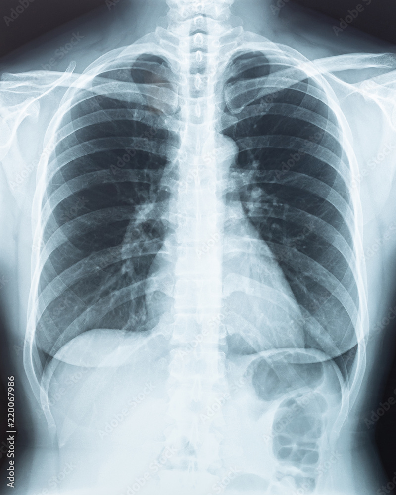 Xray Of Human Body With Internal Organs Stock Photo