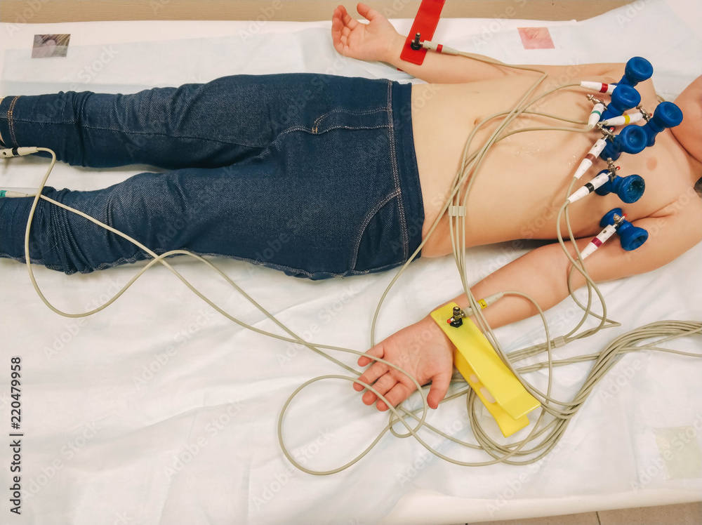 Equipment for electrocardiograms, cardiogram for a child. ECG sensors ...
