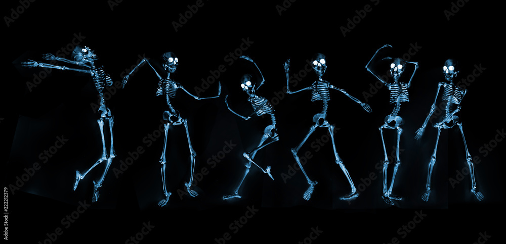 Dancing Skeletons X ray Stock Photo | Adobe Stock