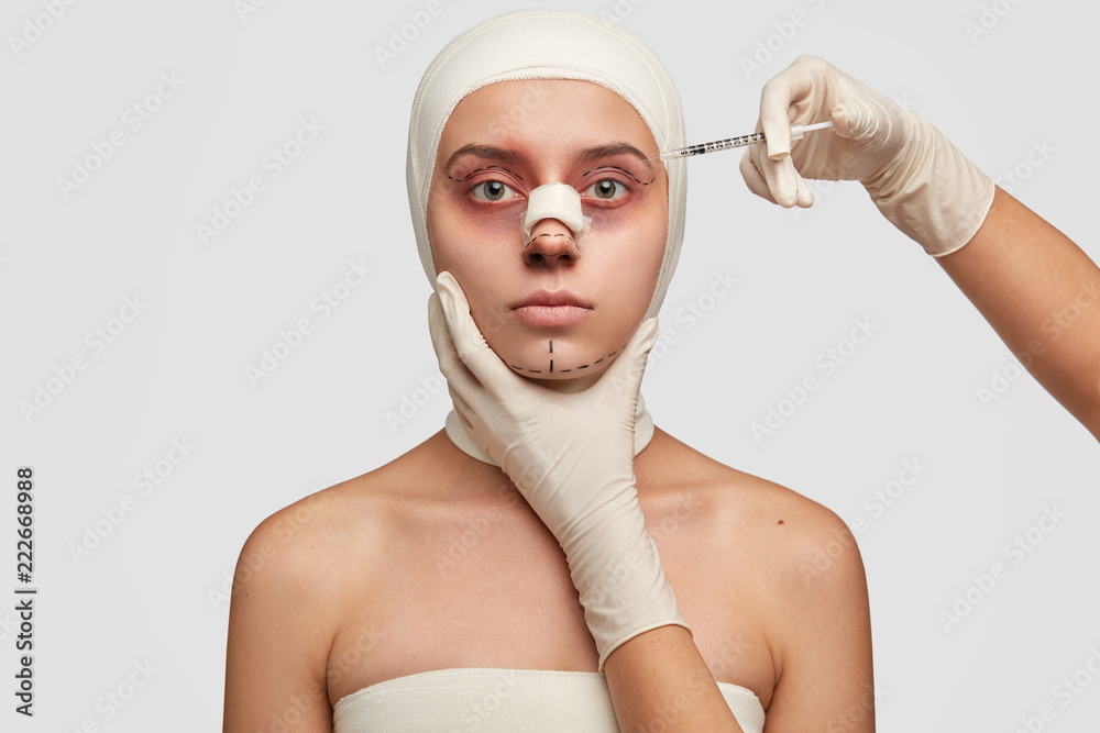 Cosmetic medical procedure concept. Woman with marks on skin, has ...
