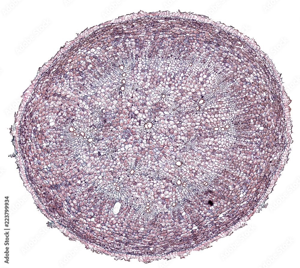 plasmodiophora brassicae root - cross section cut under the microscope ...