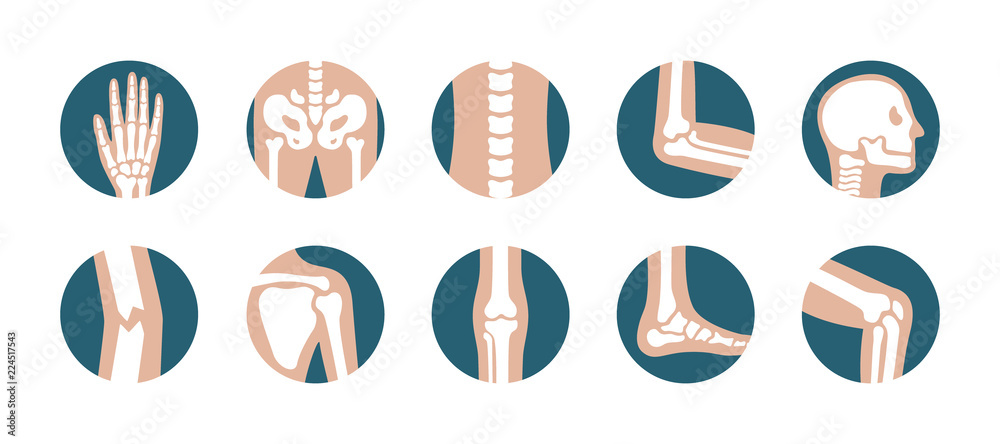 Set of human joints and bones. Vector knee, leg, pelvis, scapula, skull ...