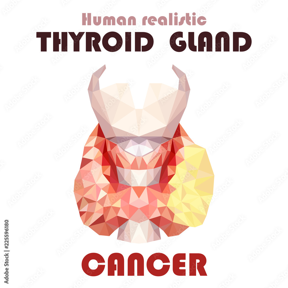 Realistic thyroid gland in low poly. Inflammation cancer Human 3d ...