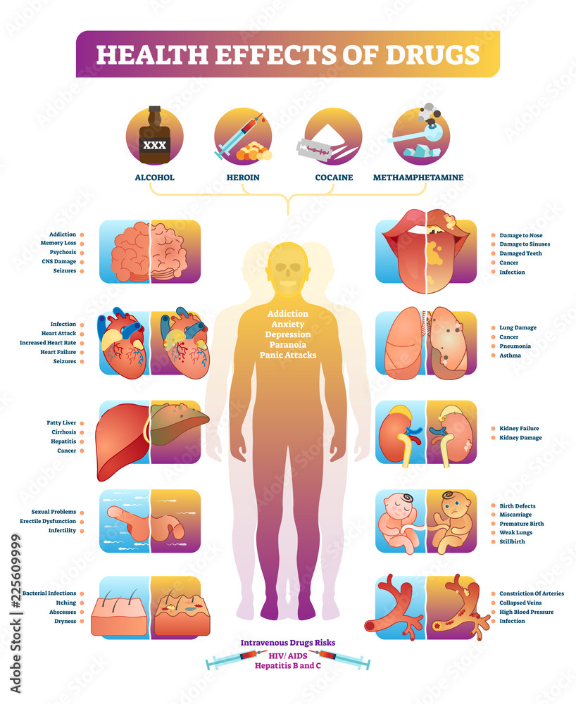 Health effects of illegal drugs vector illustration diagram. Disease ...