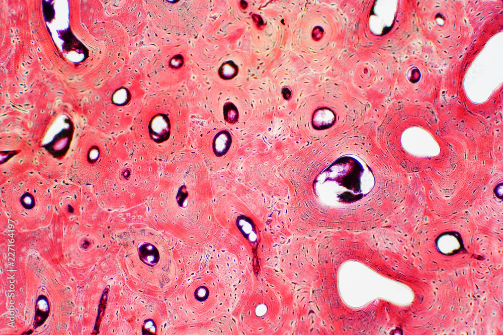 Histology of human compact bone tissue under microscope view for ...