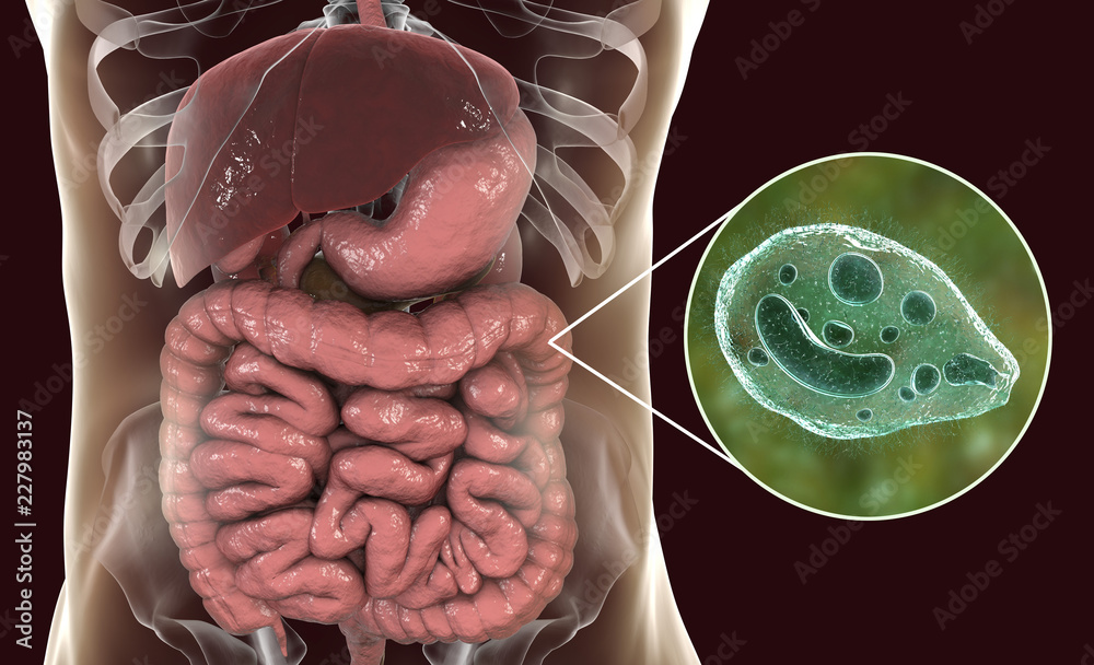 Balantidium coli protozoan in large intestine, 3D illustration ...