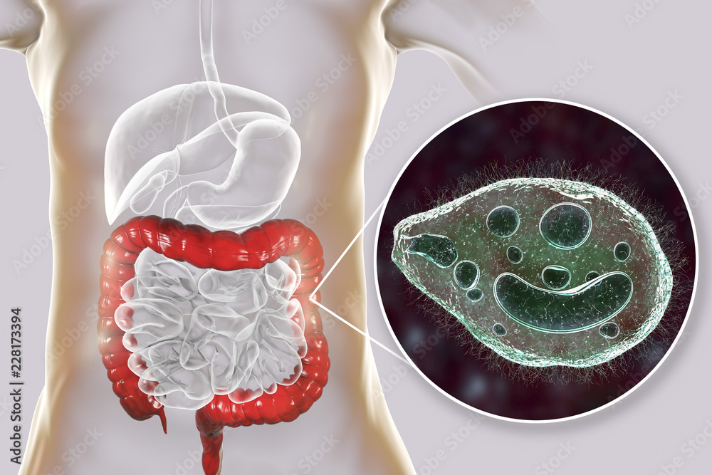Stock-Illustration „Balantidium coli protozoan in large intestine, 3D ...