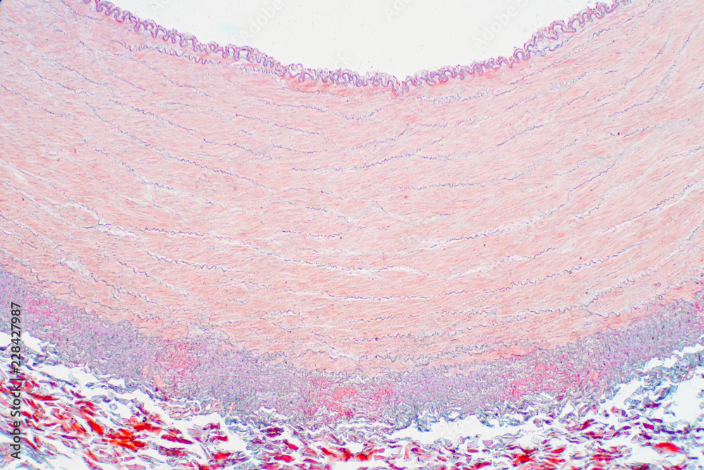 Artery blood vessel under microscope view for education histology ...