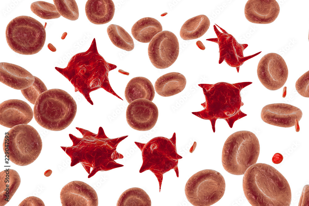 Acanthocytes, abnormal red blood cells with thorn-like projections, 3D ...