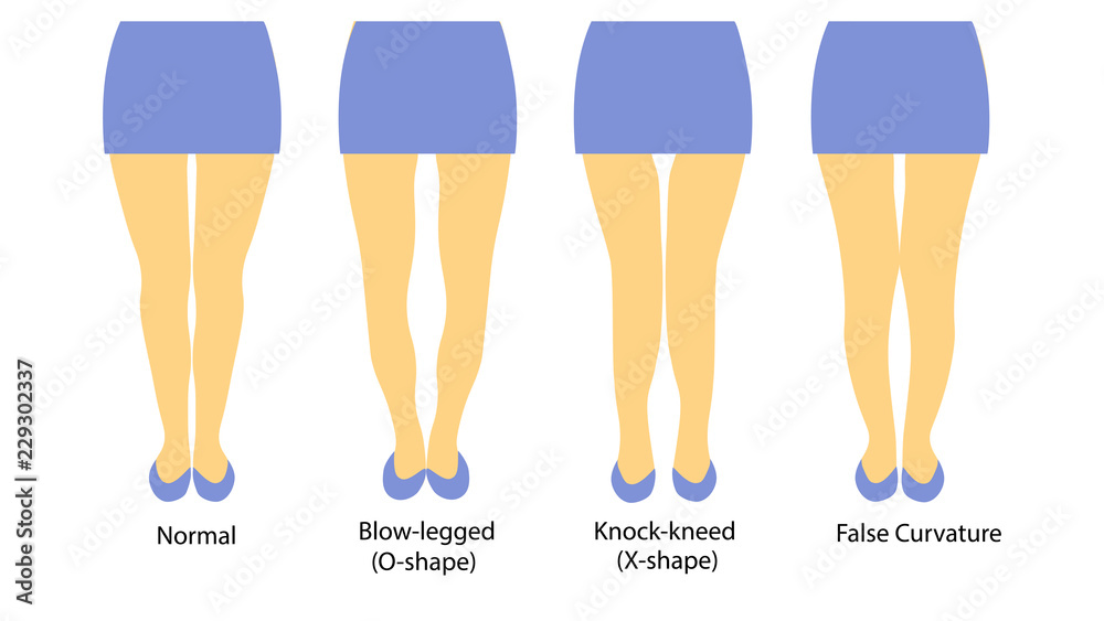 Vector illustration with different shapes of women legs Stock Vector ...