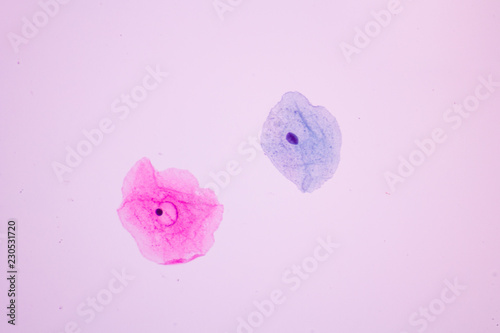 Normal squamous epithelial cells of cervical woman on white background ...