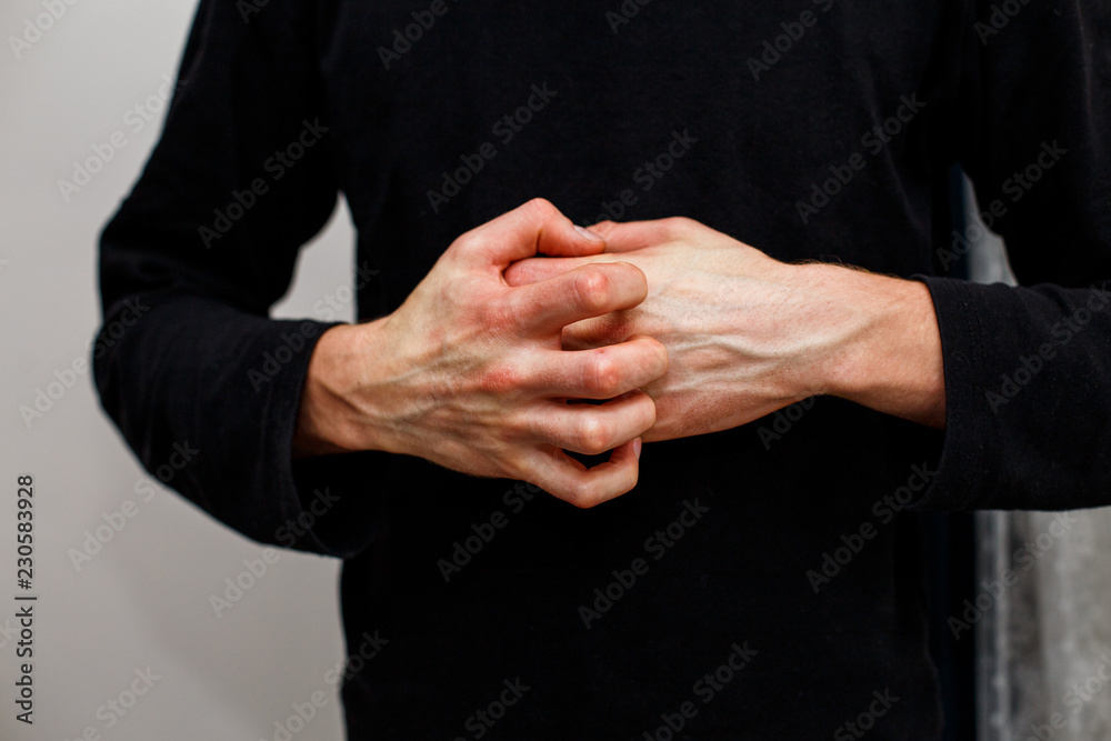 Man scratch oneself, dry flaky skin on hand with psoriasis vulgaris ...