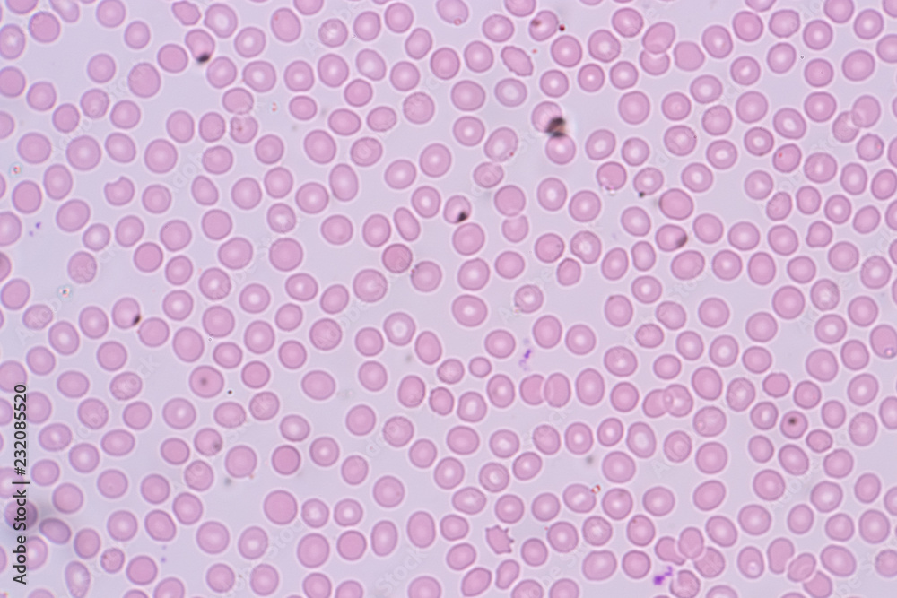 Study of white blood cells are the cells of the immune system under the ...