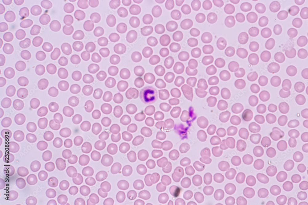 Study of white blood cells are the cells of the immune system under the ...