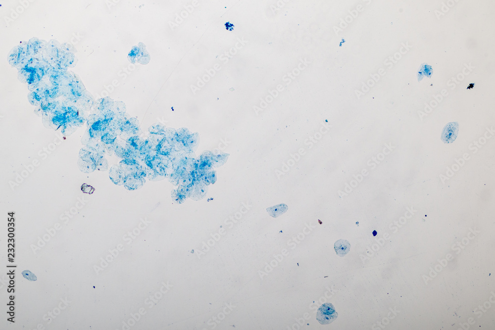 Characteristics of Squamous epithelial cell (Cell structure) of human ...