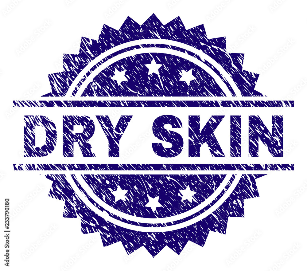 DRY SKIN stamp seal watermark with distress style. Blue vector rubber ...