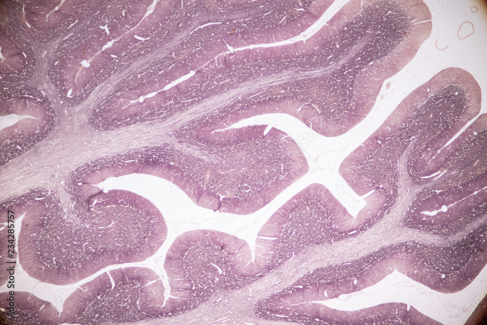 Cross section of the Cerebellum and Nerve human under the microscope ...