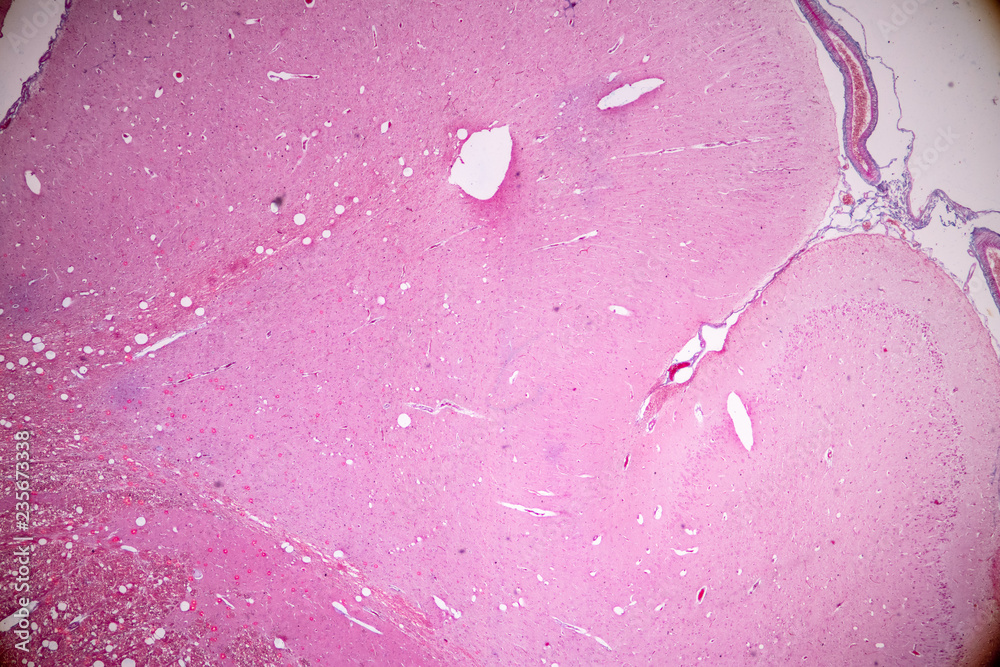 Cross section of the Cerebellum and Nerve human under the microscope ...