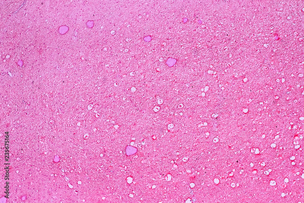 Cross section of the Cerebellum and Nerve human under the microscope ...