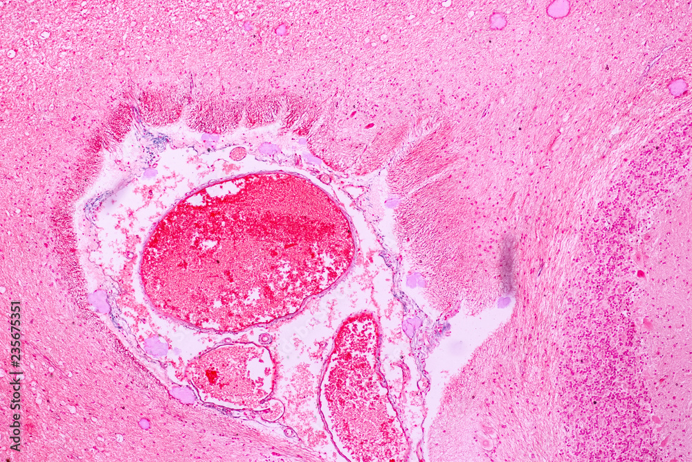 Cross section of the Cerebellum and Nerve human under the microscope ...
