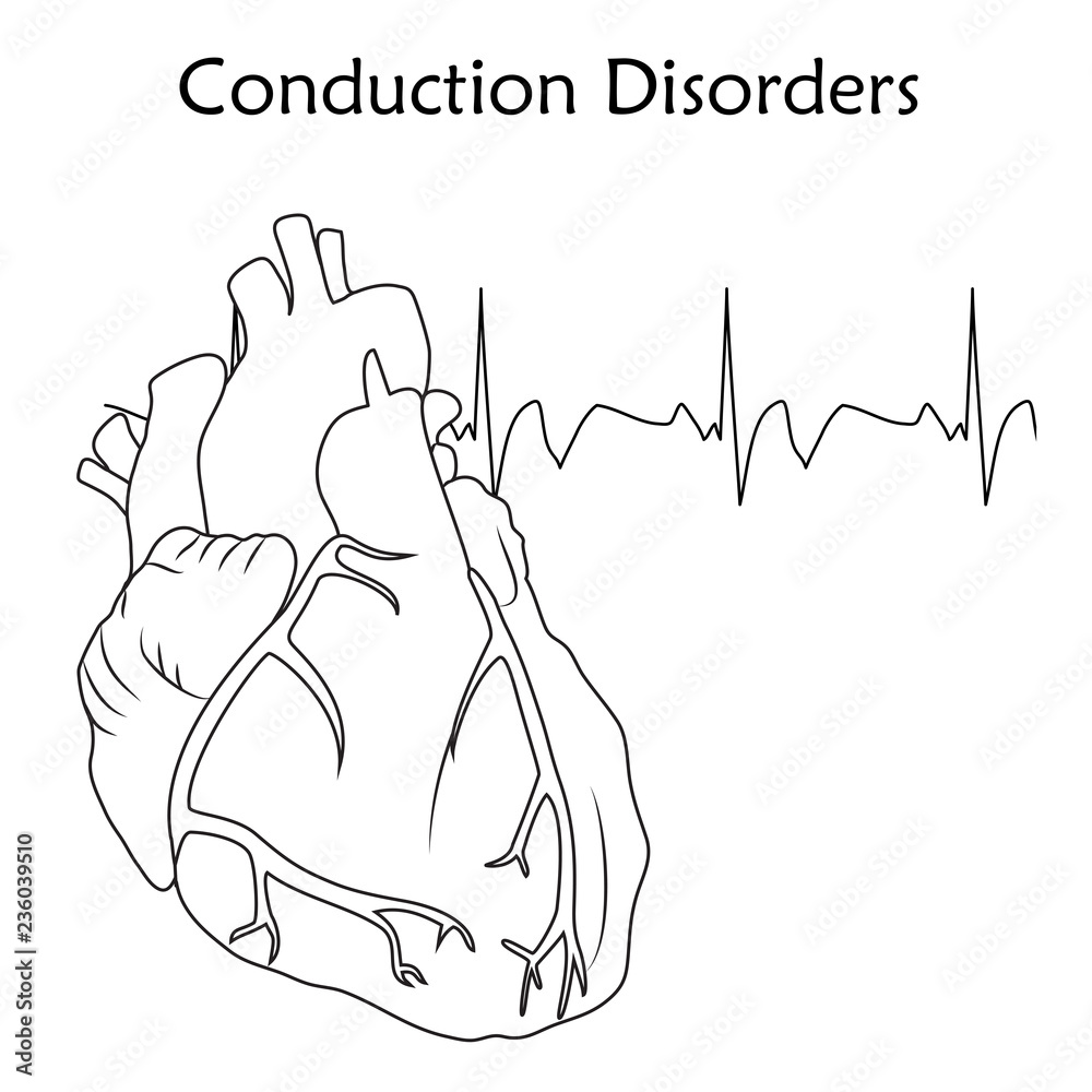 Human heart. Conduction Disorders. Anatomy flat illustration. Outline ...