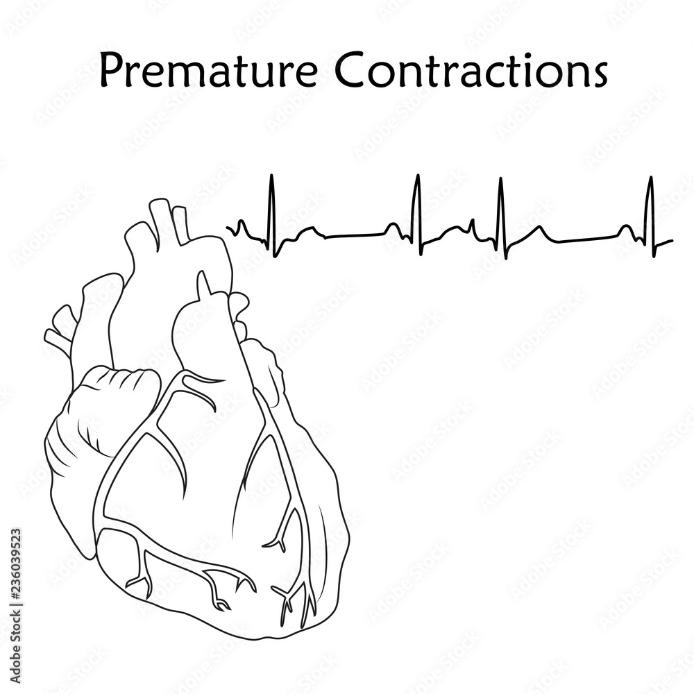 Human heart. Premature Contractions. Anatomy flat illustration. Outline ...
