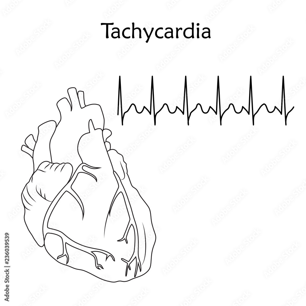 Human heart. Tachycardia. Anatomy flat illustration. Outline image ...