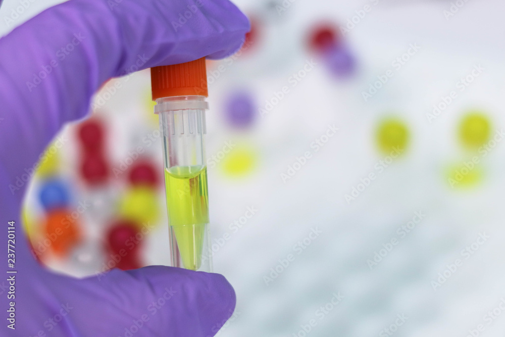 Tubes in the PCR laboratory. In vitro reagents for PCR analysis for ...