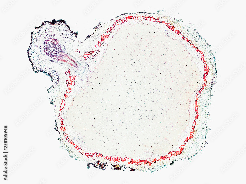 Root Nodule Cross Section Roots Plant Structure