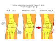 Girl And The Deer By B. Patella Free Stock Photo - Public Domain Pictures