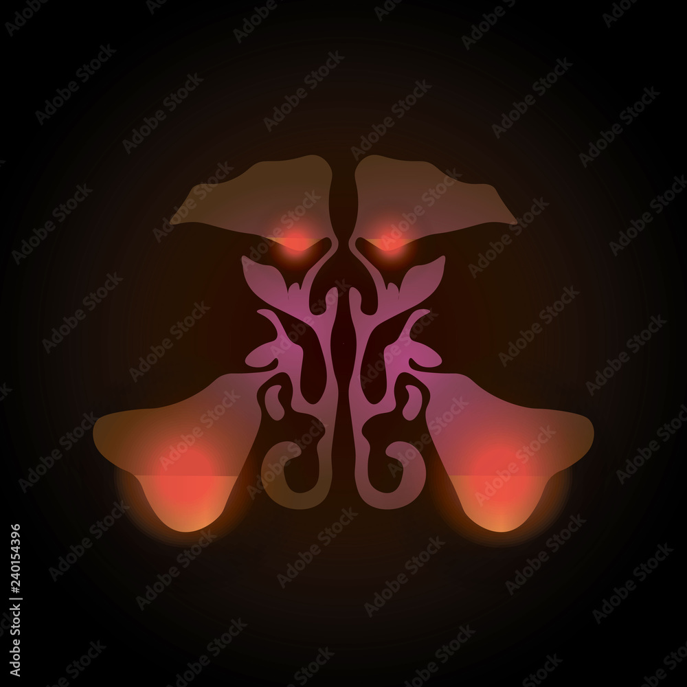maxillary sinuses with a point of pain and inflammation.. Sinusitis ...