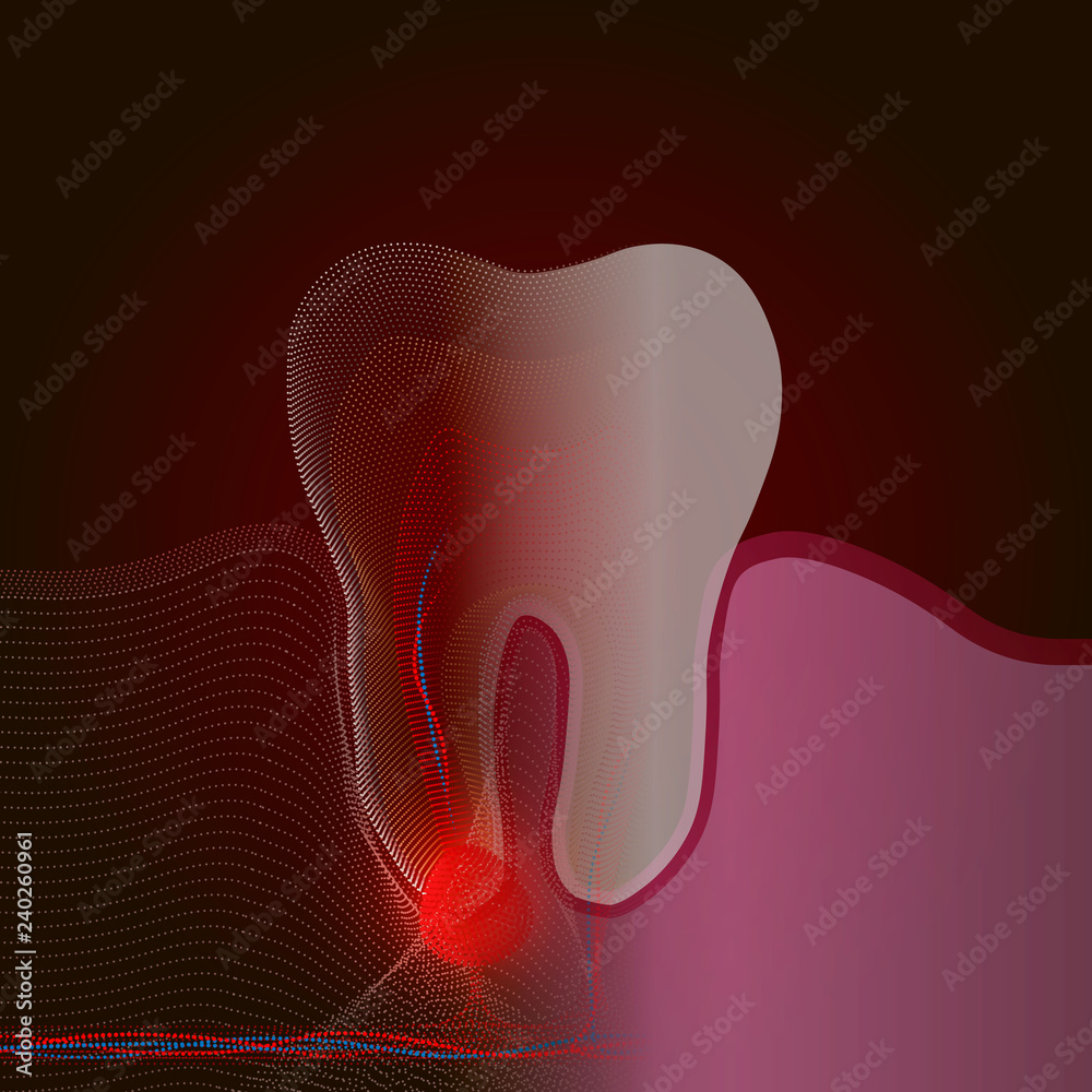 The transition from a real tooth to a point X-ray effect with a point ...