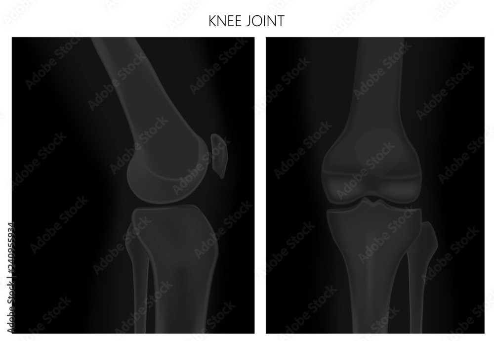 Vector illustration. Anatomy of a healthy knee joint, front and side ...
