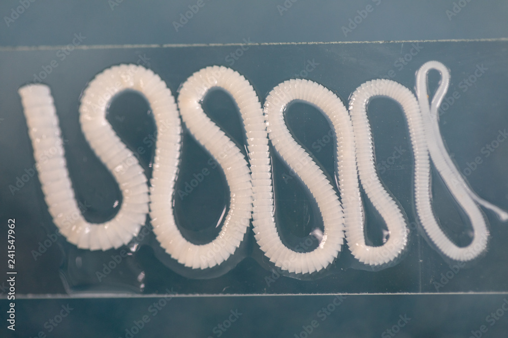 The study of Tapeworm infection is caused by ingesting food or water ...